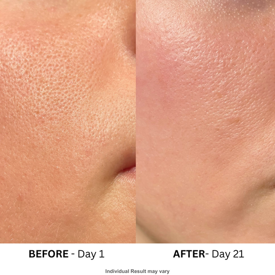 Korean Skincare Products | Venamine Pure Argan Oil For Skin & Hair ...