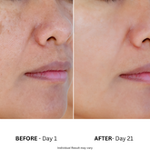 Korean Skincare Products | Venamine Pure Argan Oil For Skin & Hair ...