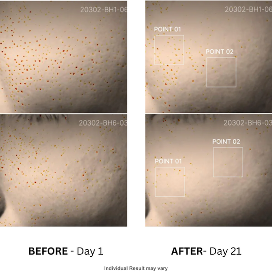 Korean Skincare Products | Venamine Pure Argan Oil For Skin & Hair ...